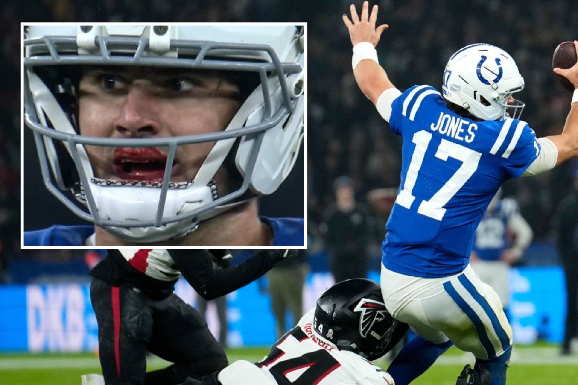 Daniel Jones raises concern for the Indianapolis Colts after his mouth ...